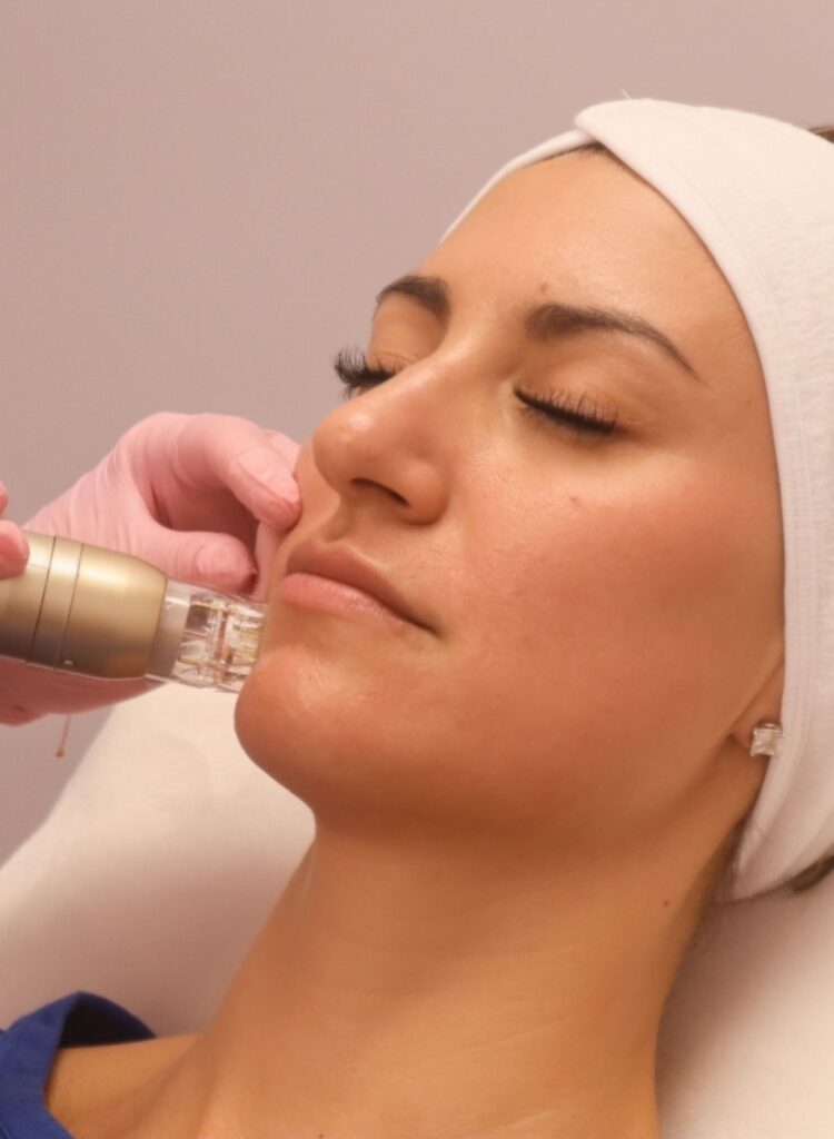 Lasers - The Laser Lounge Spa - North Naples